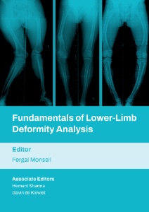 Fundamentals of Lower-Limb Deformity Analysis - Deformity Correction Hull